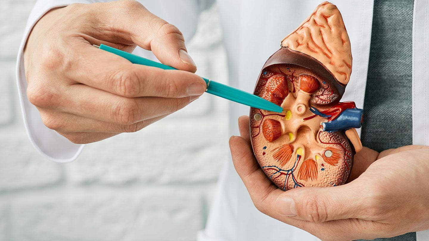 Mengenal Kista Ginjal, Penyebab, dan Cara Mengobatinya - Primaya Hospital